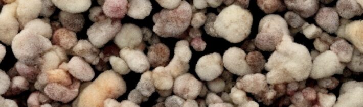 Common Types of Skin Fungus: A Compassionate Guide to Understanding and ...